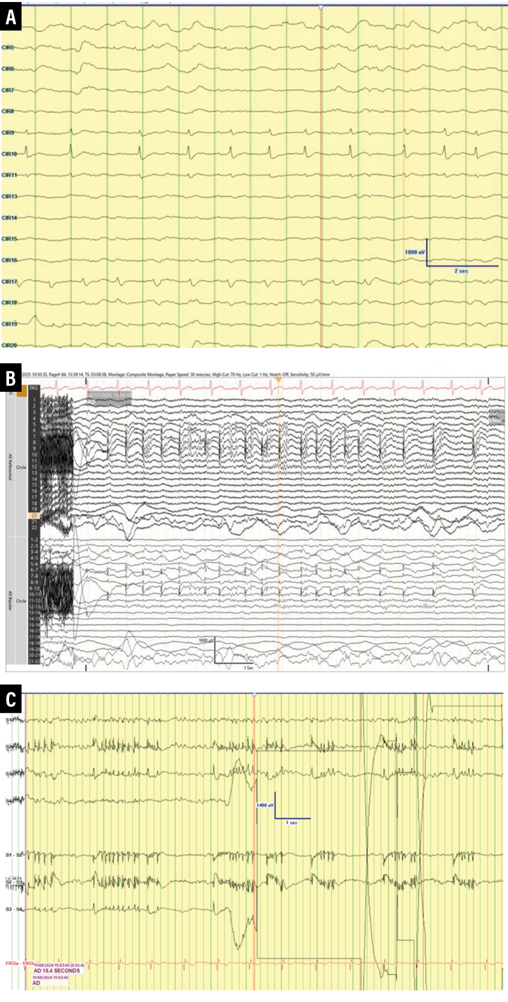 Practical Uses of EEG in the Operating Room