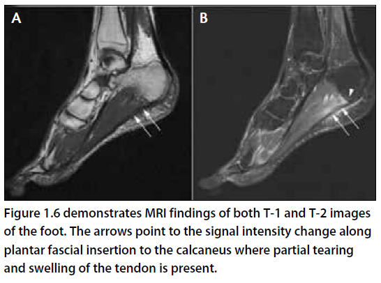 Expert Opinion: A Review of the Evaluation and Treatment of