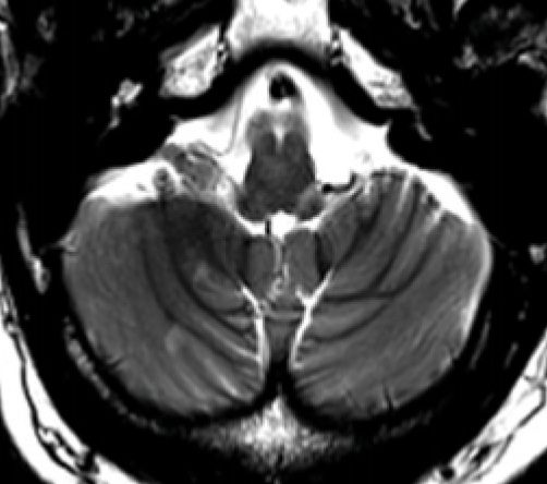 The Multiple Sclerosis Lesion Checklist