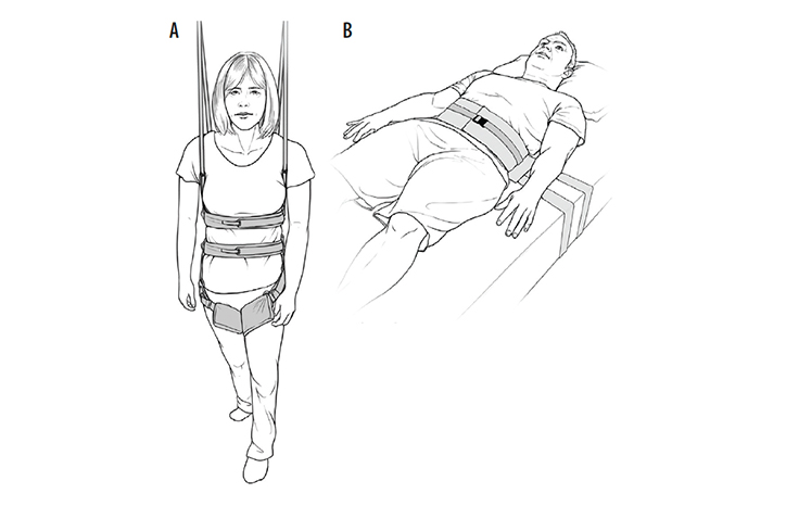 Epilepsy Essentials: VideoEEG Monitoring