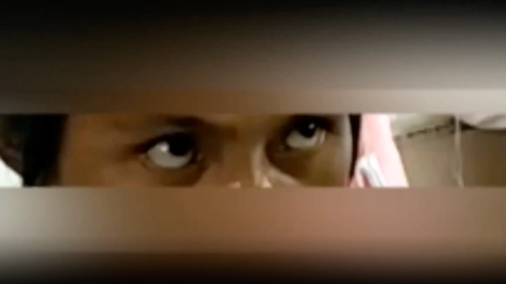 Ocular bobbing in eosiniphilic meningitis resolving