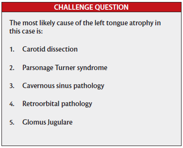 Tinnitus and Otalgia in a 41-year-old Woman